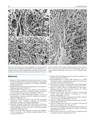 Tumors of the fetus and infant | PDF