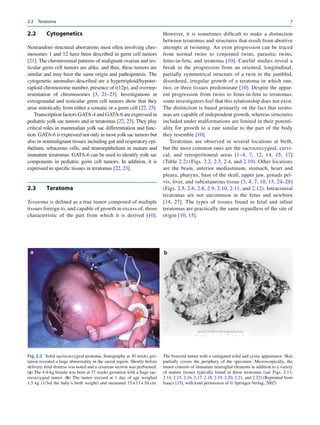 Tumors of the fetus and infant | PDF