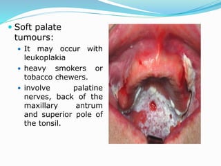 Tumors of the oral cavity and oropharynx | PPTX