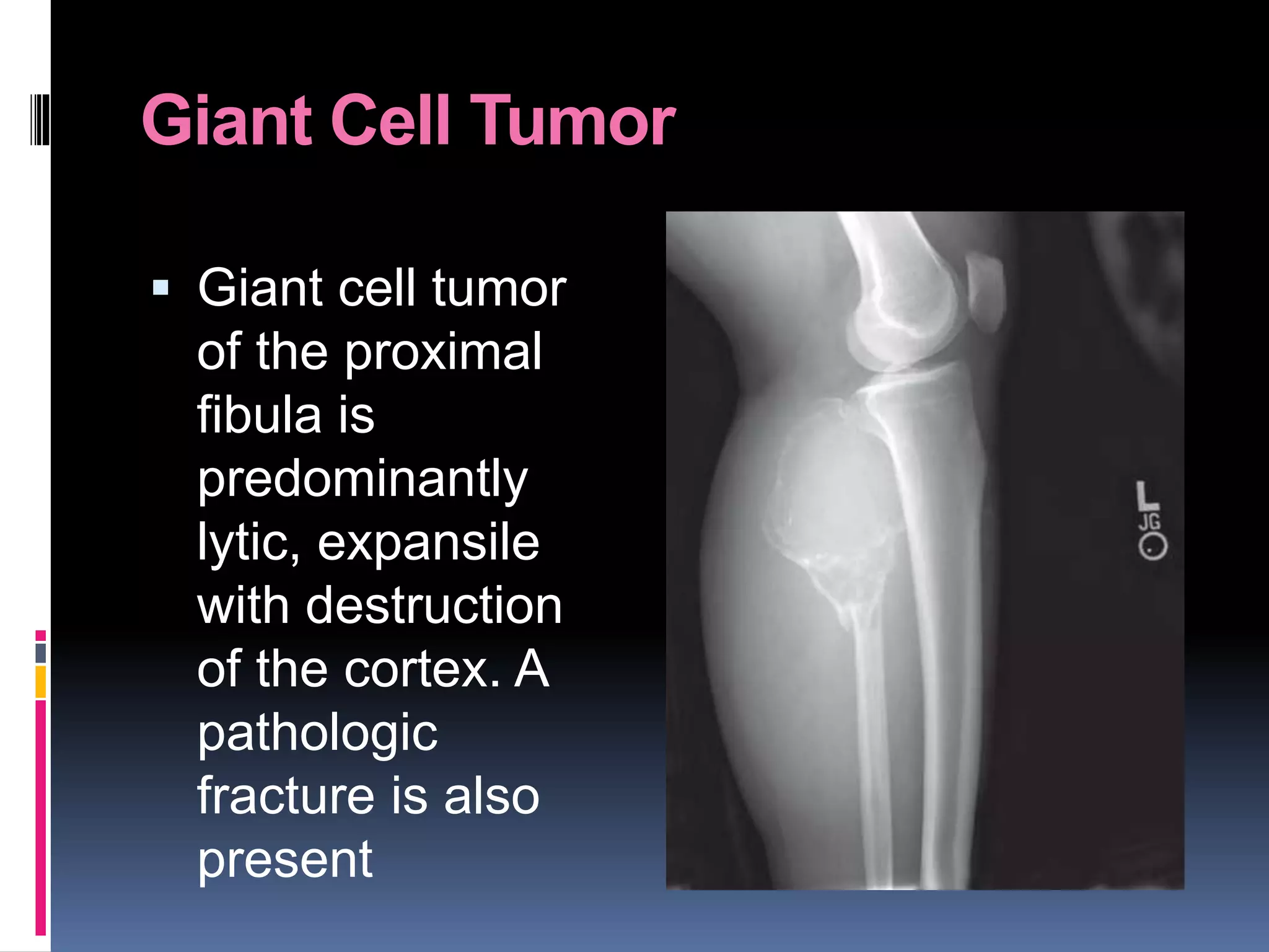 Tumors of unknown origin.ppt