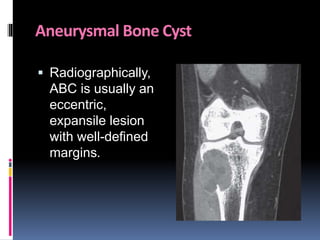 Tumors of unknown origin.ppt