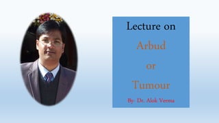 Tumour (Arbuda) | PPTX
