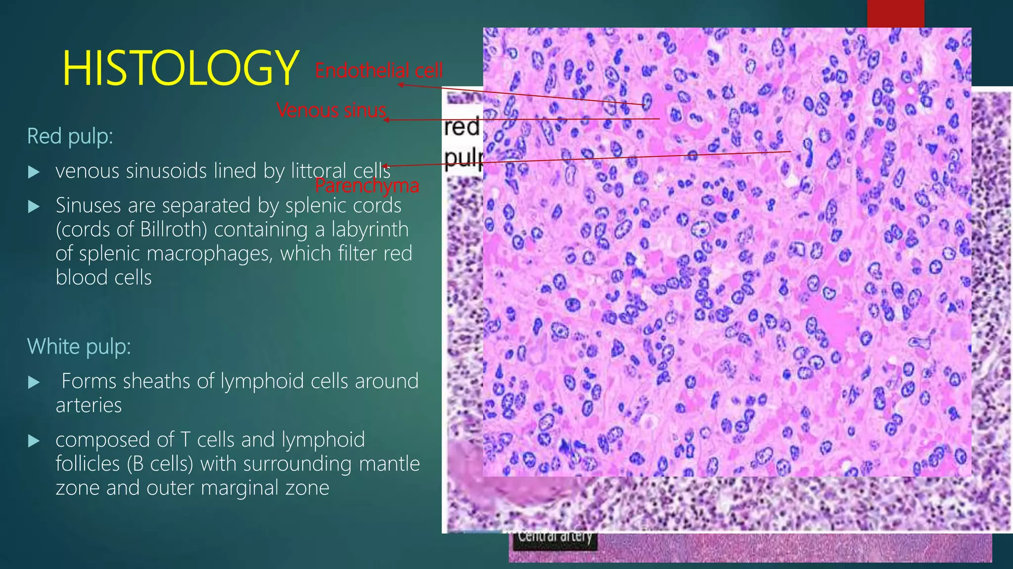 Tumour and tumour like lesions of spleen | PPTX
