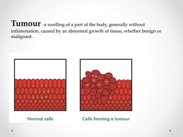 Tumour/cancer | PPTX | Blood Disorders | Diseases and Conditions