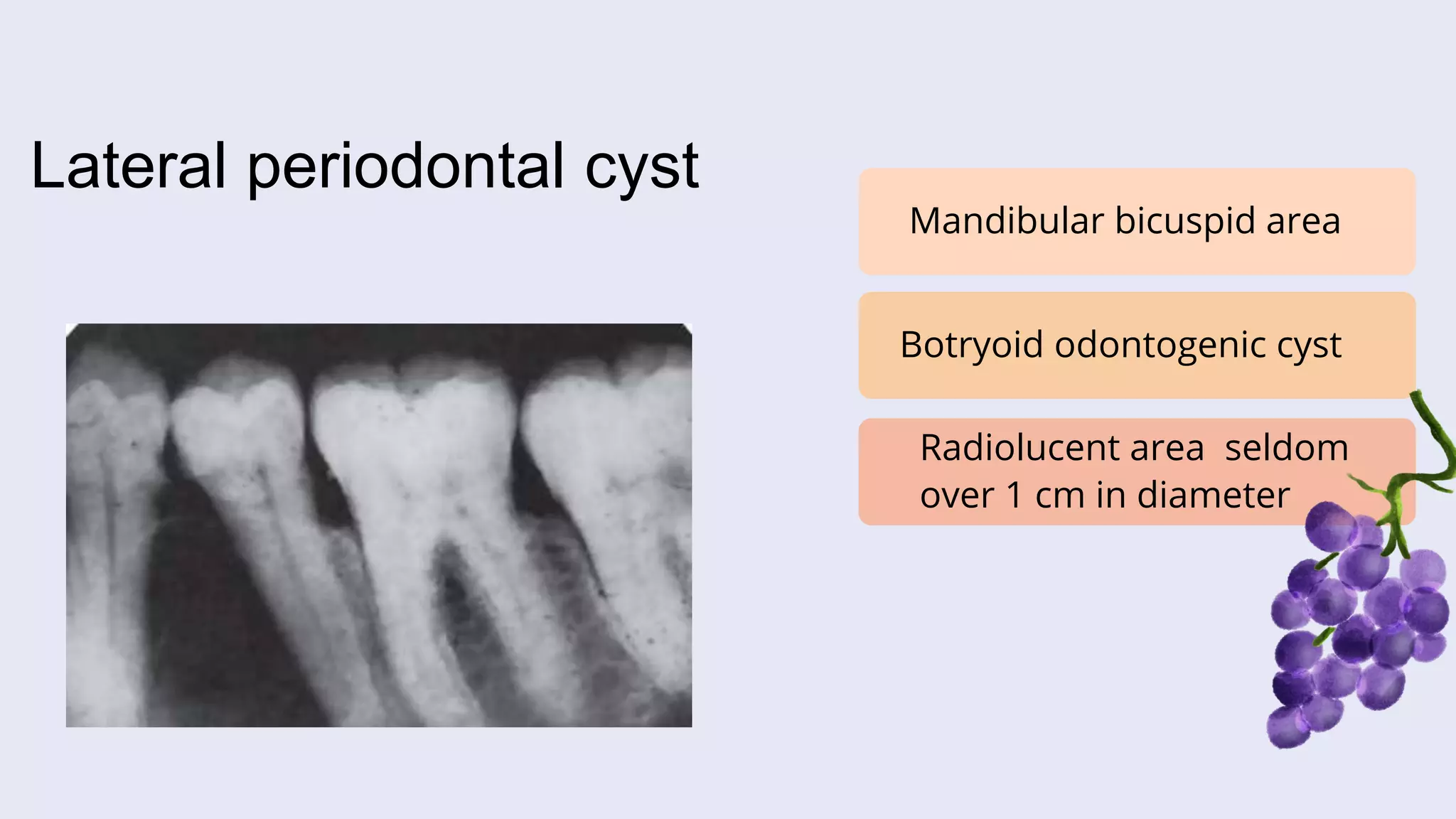 TUMOURS AND CYSTS OF JAW.pptx