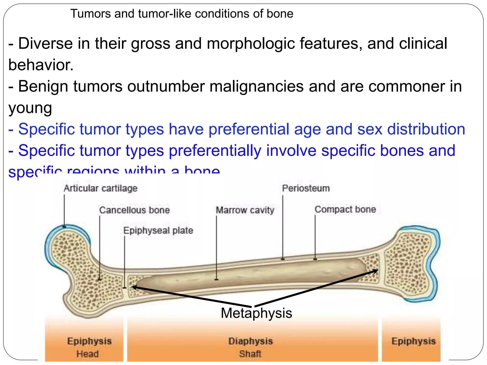Tumours of bones, cartilage & joints mbbs lect | PPTX