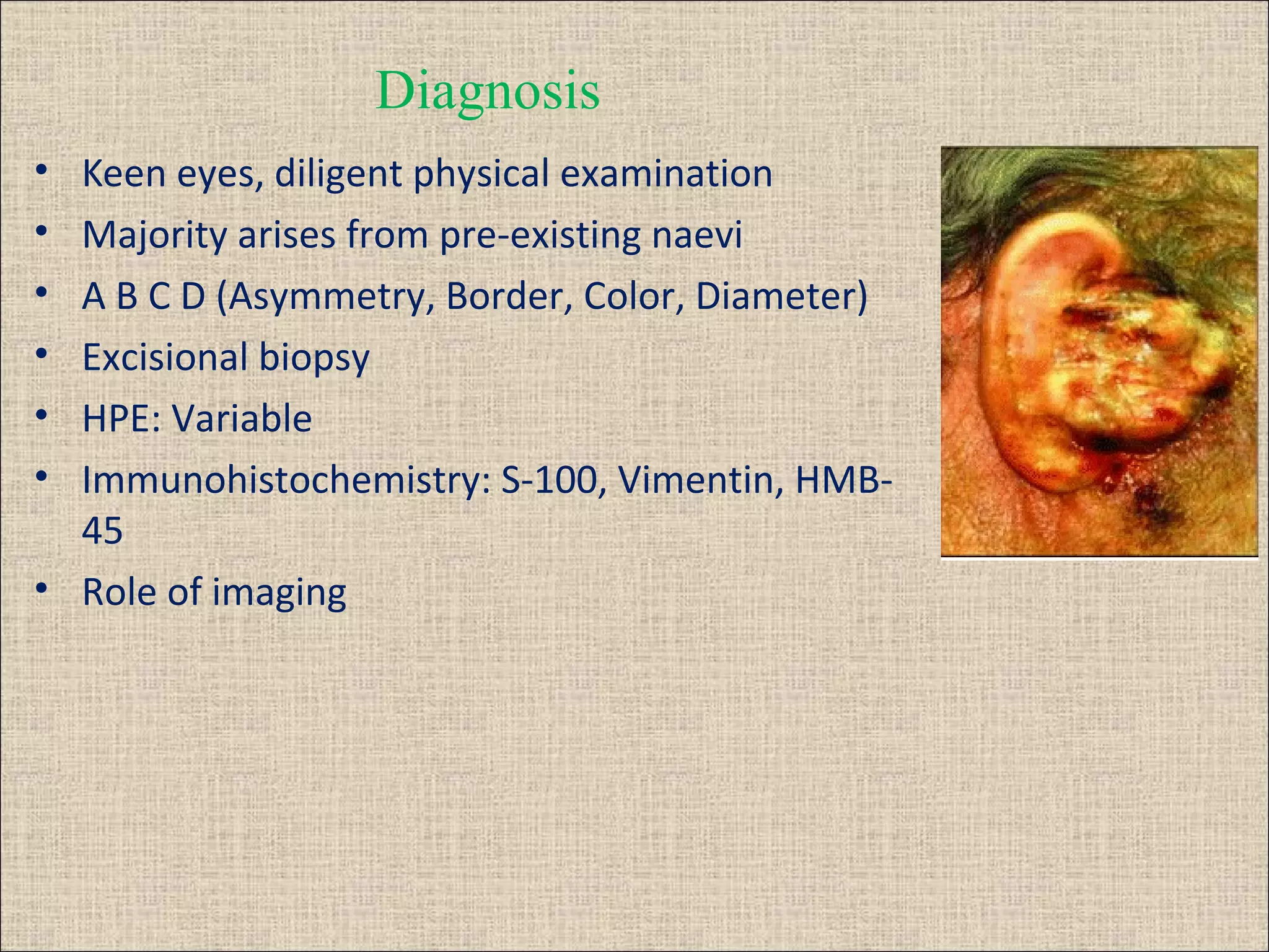 Tumours of external and middle ear | PPT