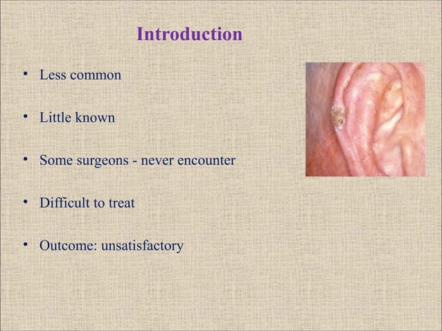 Tumours of external and middle ear | PPT | Cancer | Diseases and Conditions