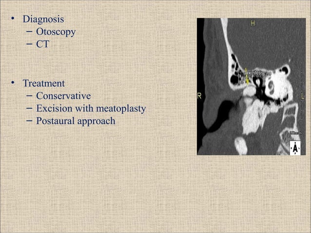 Tumours of external and middle ear | PPT | Cancer | Diseases and Conditions