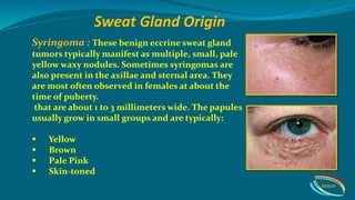 Tumours of eyelid | PPTX