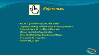 Tumours of eyelid | PPTX