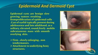 Tumours of eyelid | PPTX