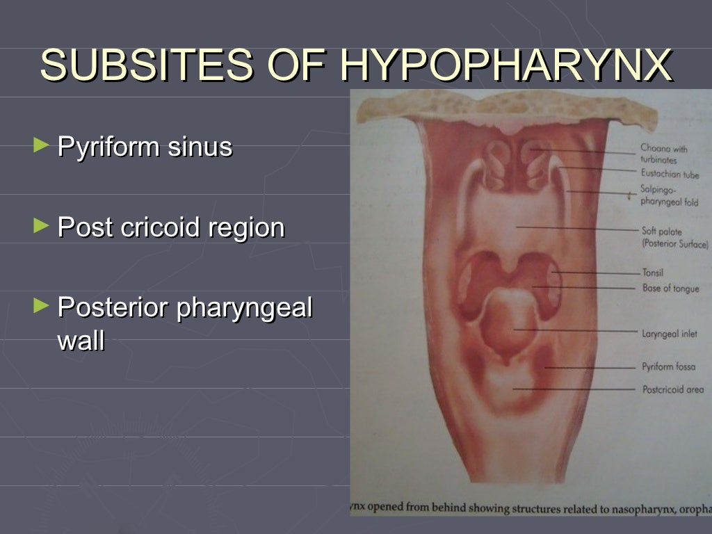 Tumours of hypopharynx