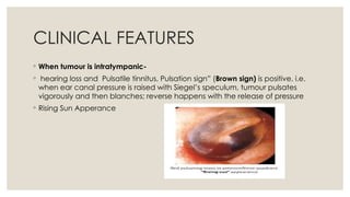 Tumours of middle ear and mastoid cavity.pptx