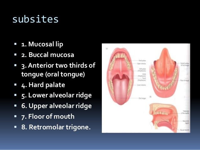 Retromolar Trigone Anatomy Classification Of The Retromolar Triangle