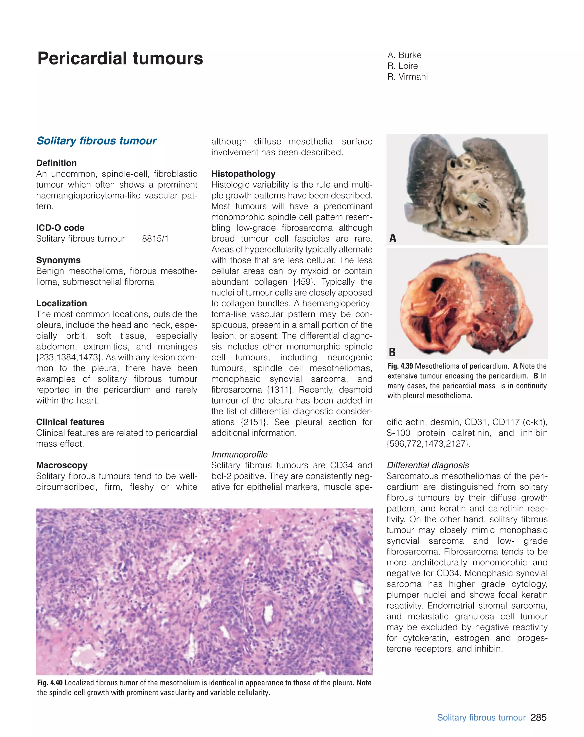 Tumours of the heart | PDF