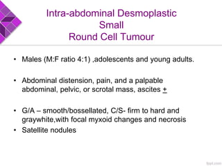 Tumours of the peritoneum | PPTX