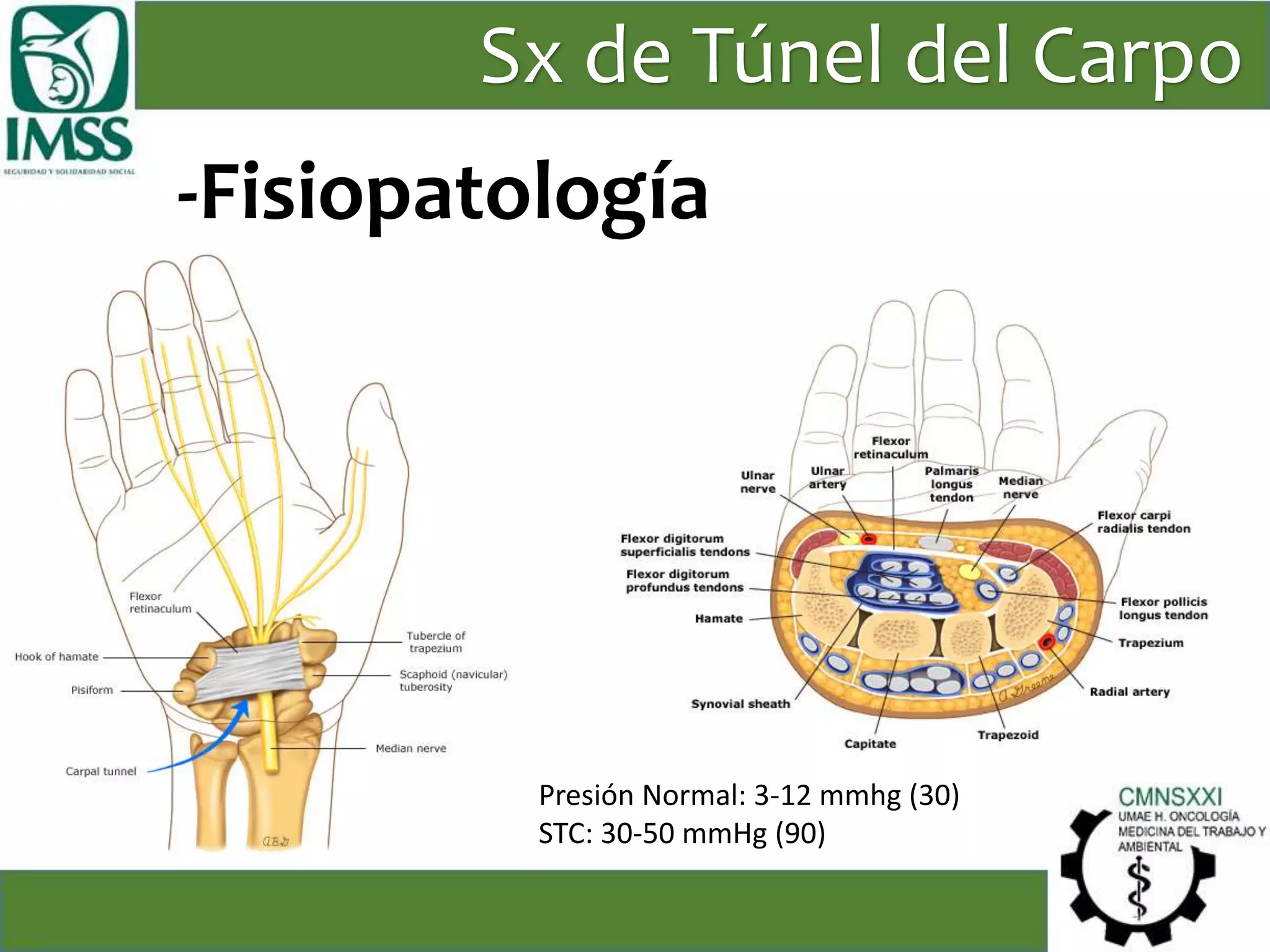 Tunel del carpo | PPT