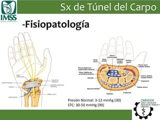 Tunel del carpo | PPTX