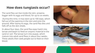 tungiasis parasites diseases lecture.pptx