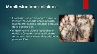 una vista general sobre la tungiasis.pptx