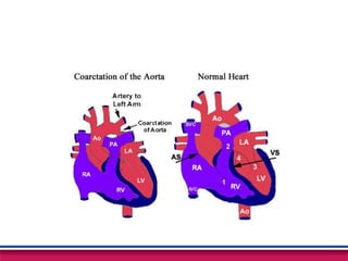 Tuần hoàn-suy-tim-yđk- ở trẻ em - nhi khoa | PDF