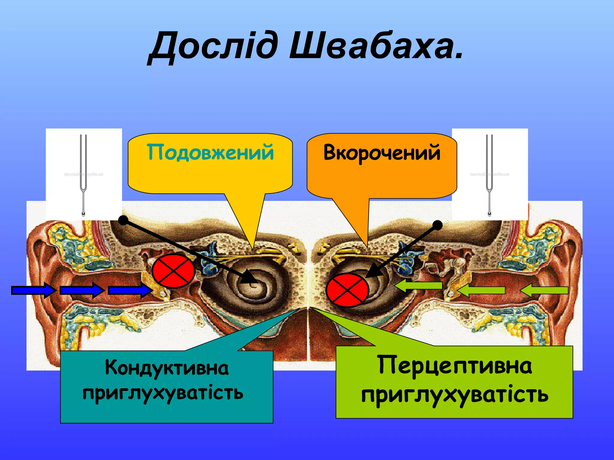 Tuning forks tests | PPT