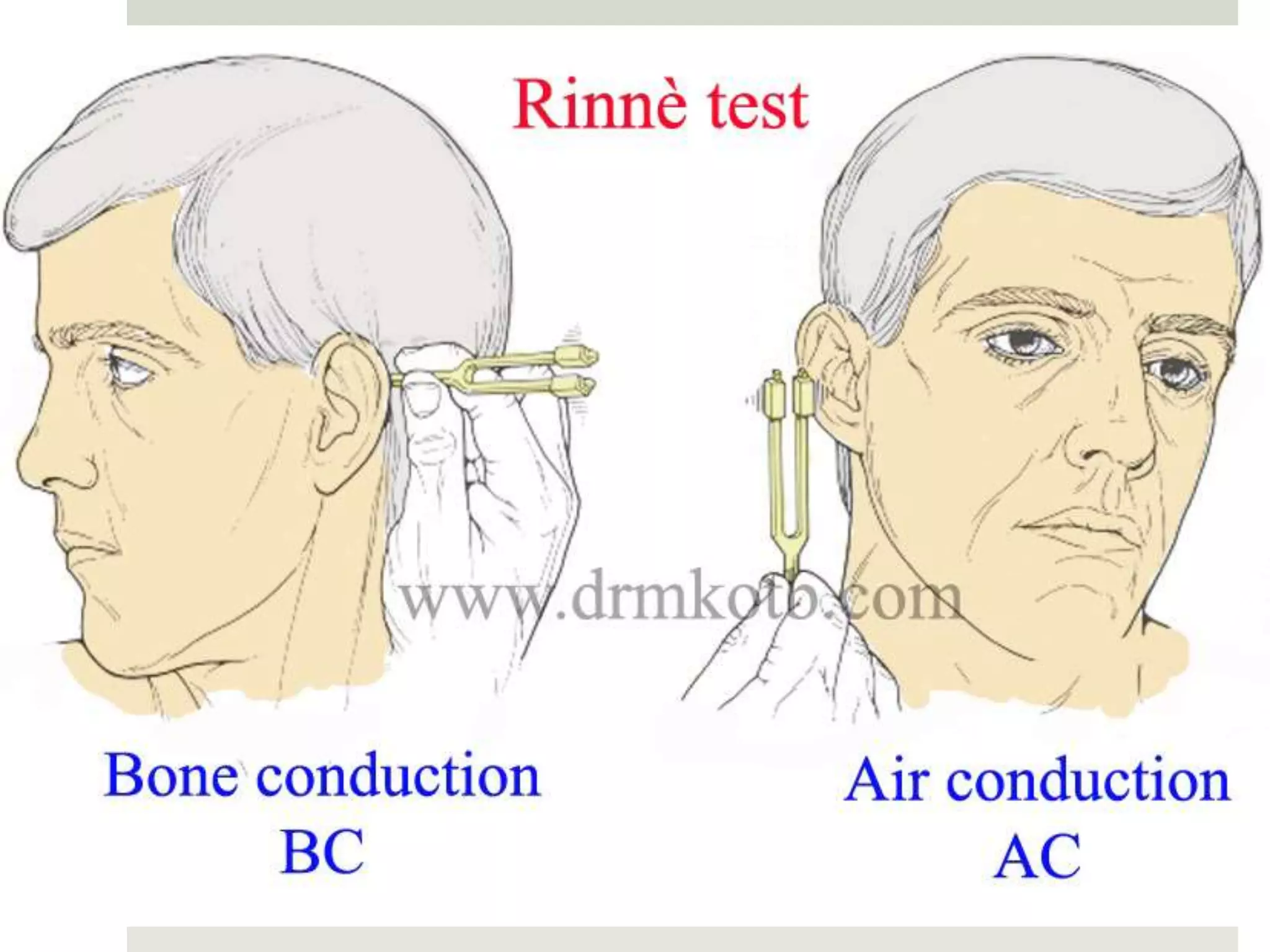 Tuning fork tests | PPTX