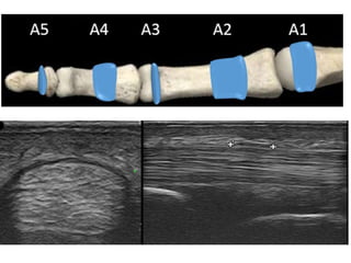 Ultrasound Guided Minimally Invasive Interventions for the Common ...