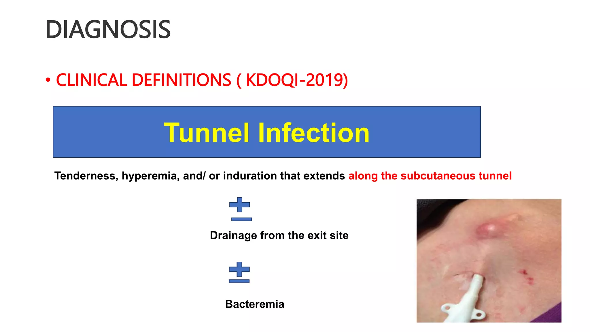Tunneled Hemodialysis Catheter-Related Infections.pptx