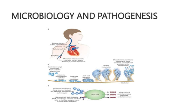 Tunneled Hemodialysis Catheter-Related Infections.pptx