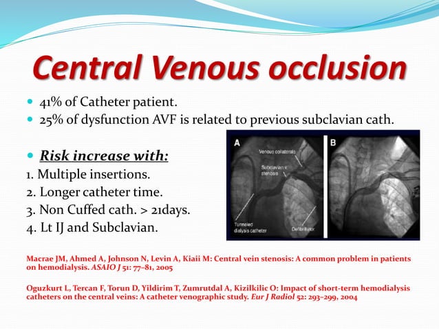 Tunnelled cuffed catheter (permacath) | PPTX