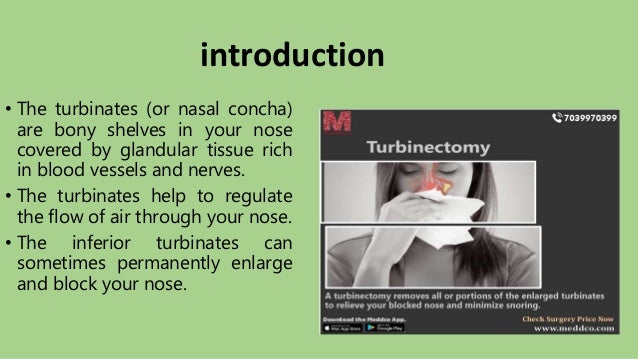 Turbinectomy.pptx