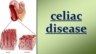 celiac disease case presentation and topic | PPTX
