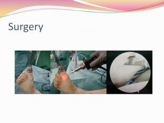 Project 1: Turf Toe | PPTX