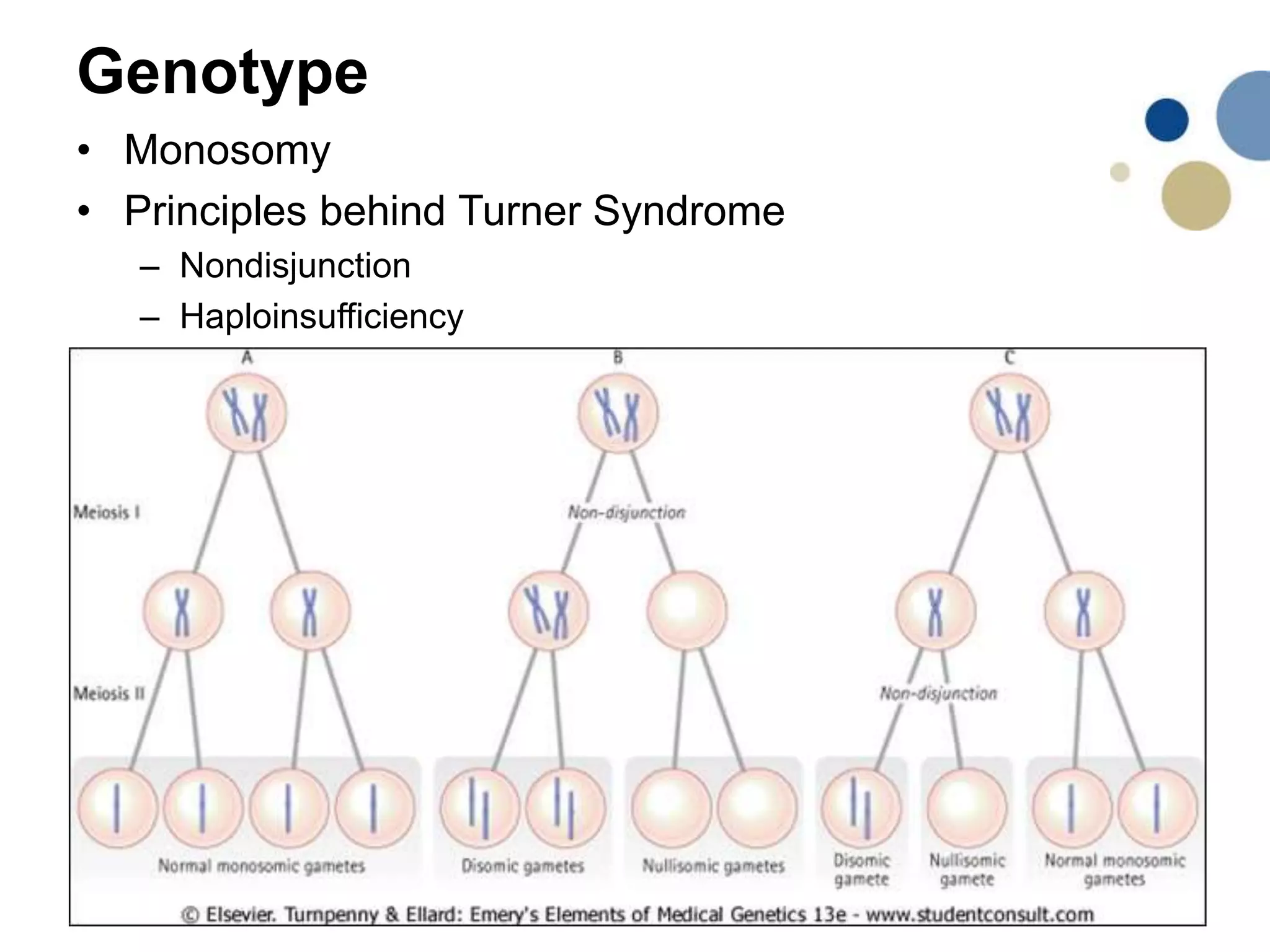 Turner syndrome presentation last | PPTX