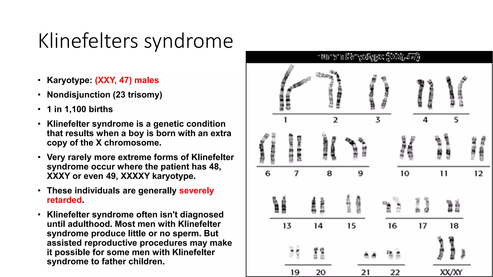 TURNERS & KLIENFELTERS SYNDROME.pptx