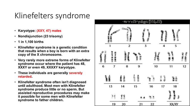 TURNERS & KLIENFELTERS SYNDROME.pptx
