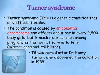 Turner's syndrome | PPTX