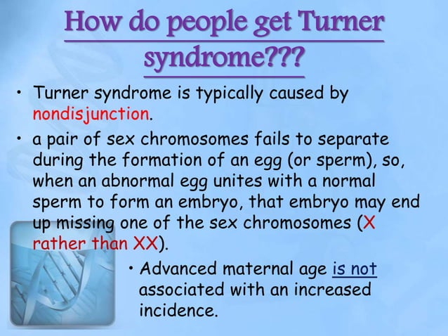 Turner's syndrome | PPTX