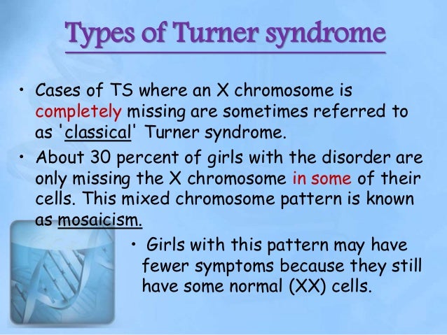 Turner's syndrome