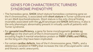 Turners syndrome | PPTX