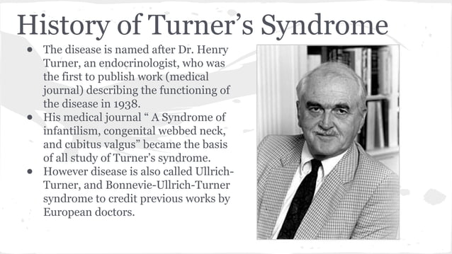 Turner's Syndrome .pptx