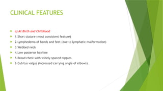 TURNER’S SYNDROME affecting Females onlu | PPTX