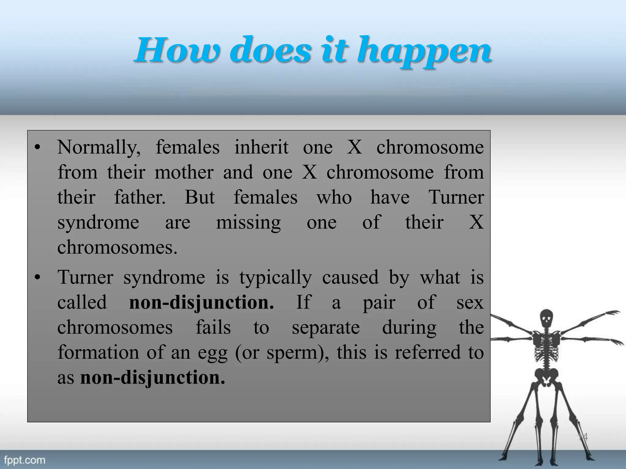 TURNER SYNDROM and causes any type sign symptoms | PPT