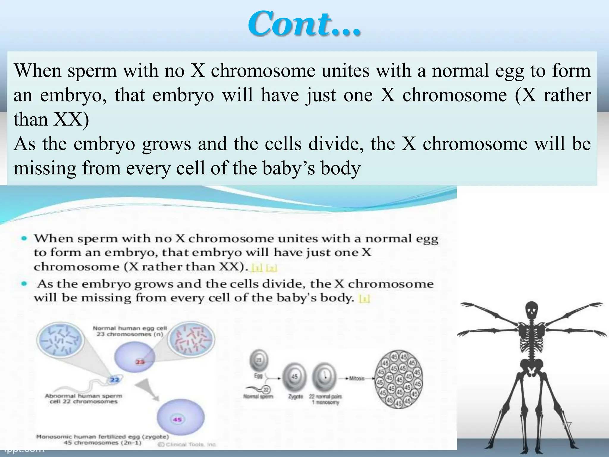 TURNER SYNDROM and causes any type sign symptoms | PPT