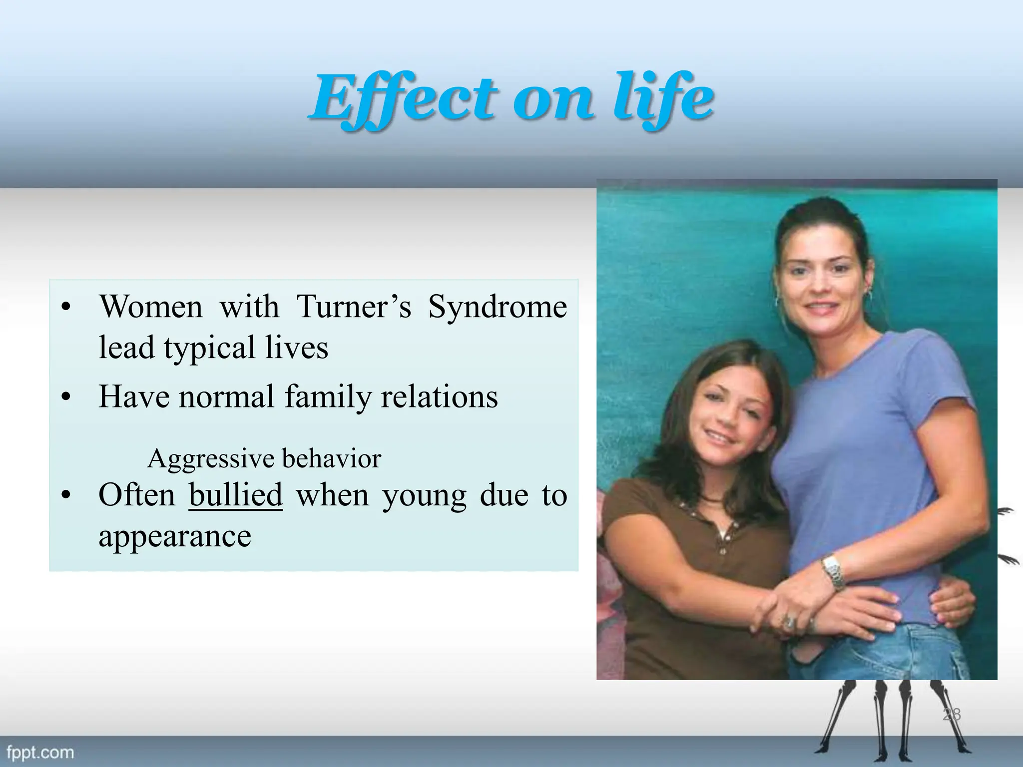 TURNER SYNDROM and causes any type sign symptoms | PPT