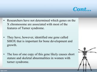 TURNER SYNDROM and causes any type sign symptoms | PPT