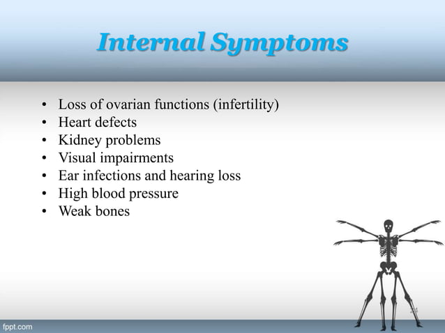 TURNER SYNDROM and causes any type sign symptoms | PPT