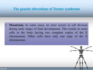 TURNER SYNDROM and causes any type sign symptoms | PPTX